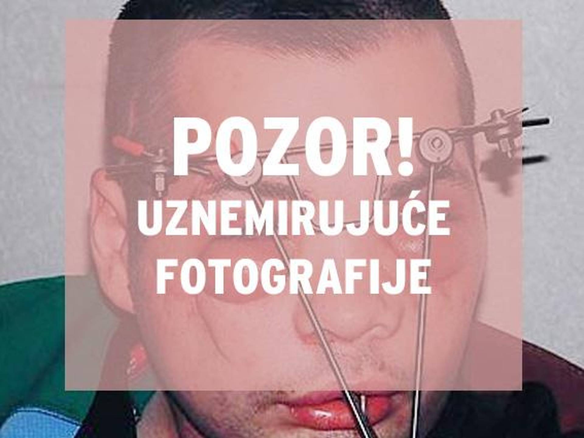 Galerija slika - Vratili mu osmijeh na lice nakon 100 sati operacija ...