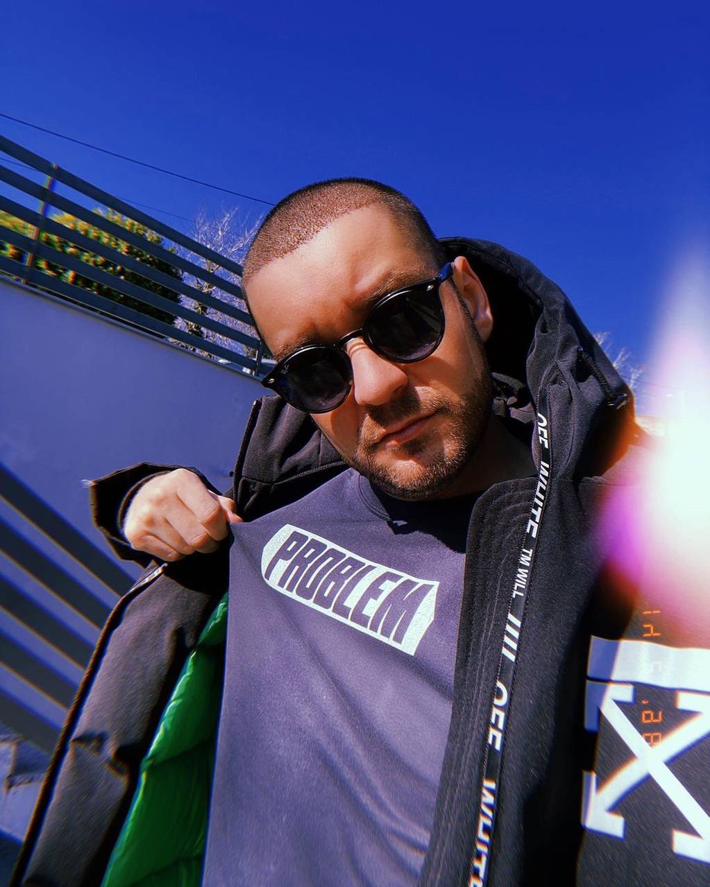 FOTO Zbogom, ćelavosti! Ovi su slavni muškarci presadili kosu: Ovako su ...