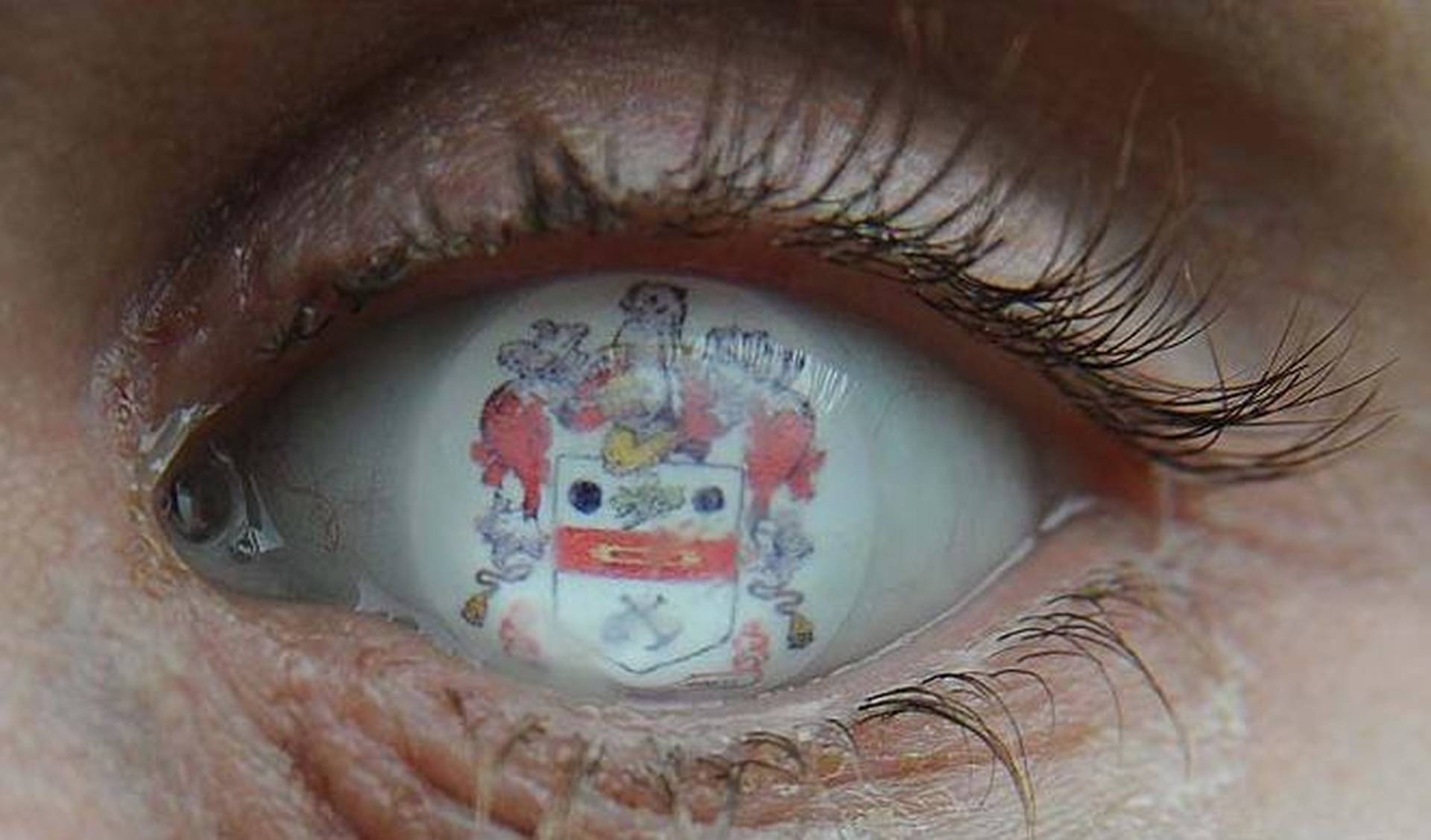 Galerija slika - Vratili mu osmijeh na lice nakon 100 sati operacija ...