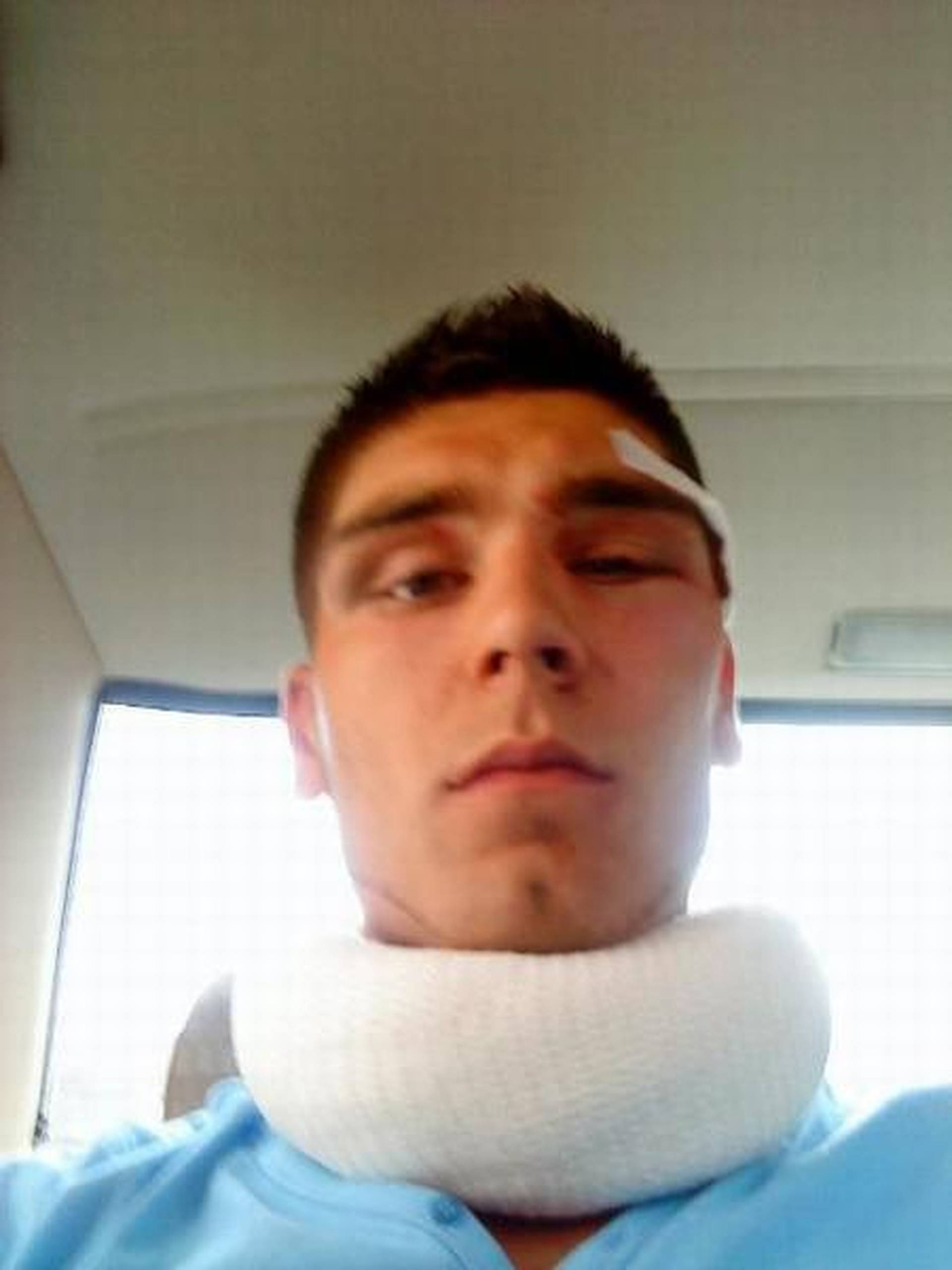 Galerija slika - Hamdija Seferović istukao mladića i razbio mu arkadu ...