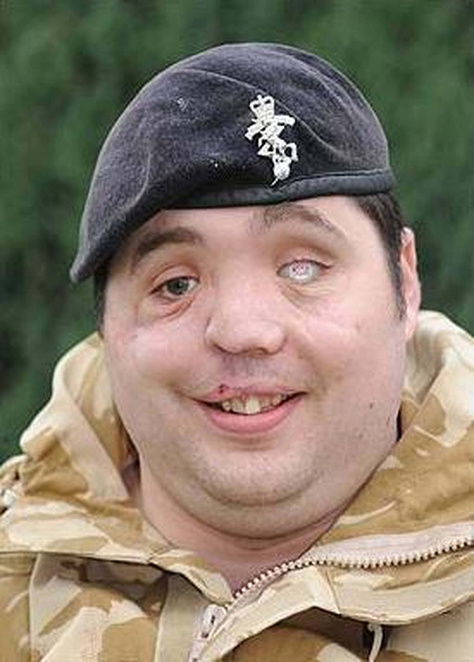 Galerija slika - Vratili mu osmijeh na lice nakon 100 sati operacija ...